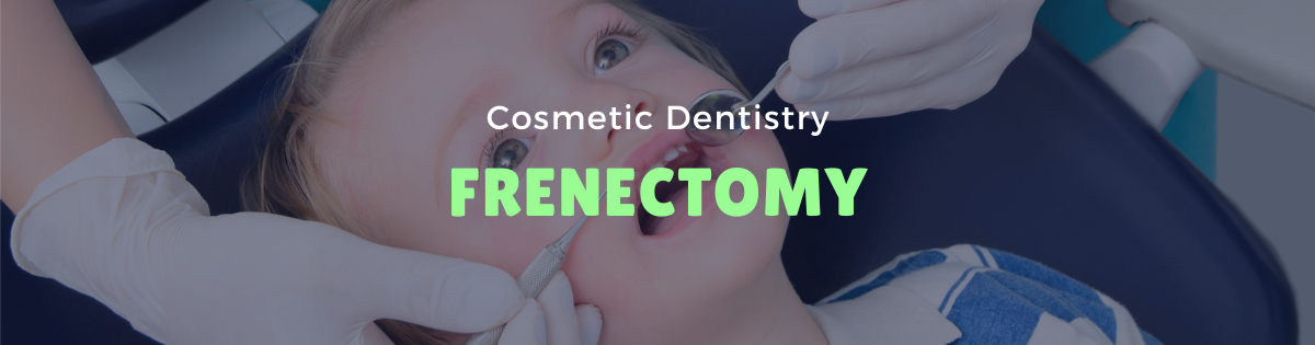 Frenectomy Lanie Family Dentistry